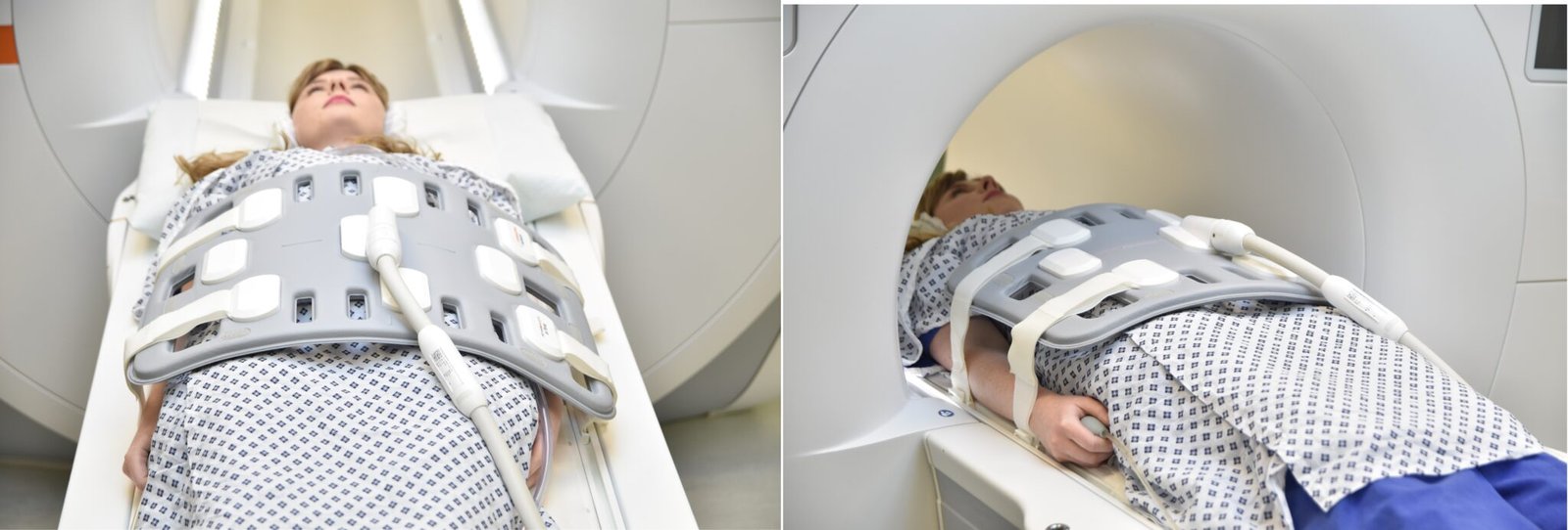 NATIVE MRI | Native Space MRI | NATIVE MRA Protocol and Planning