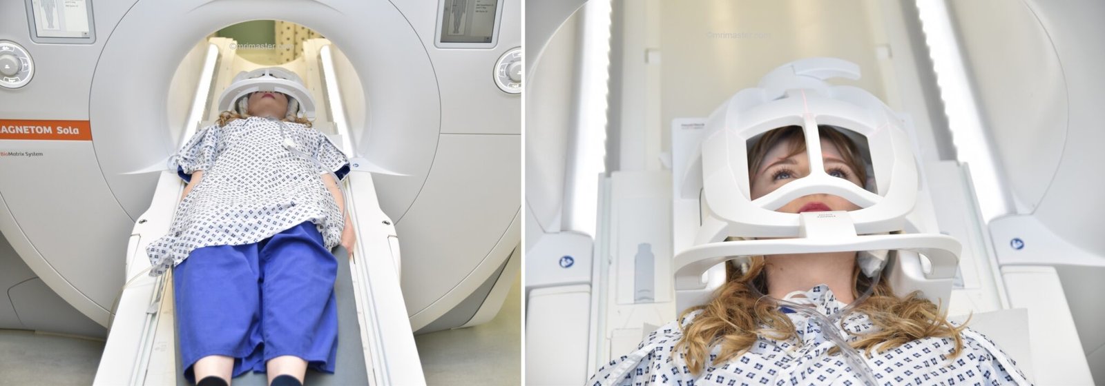 Multiple sclerosis (MS) MRI protocol and planning | MS MRI brain and ...