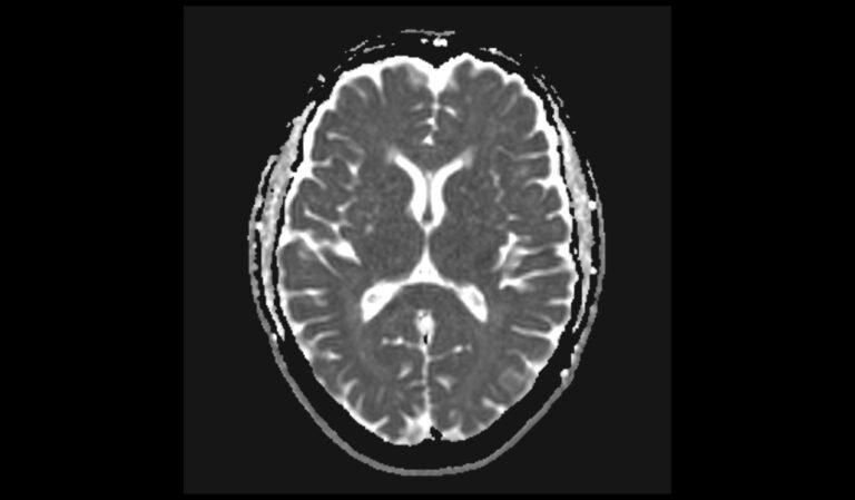 PLAN BRAIN IMAGE dwi - mrimaster