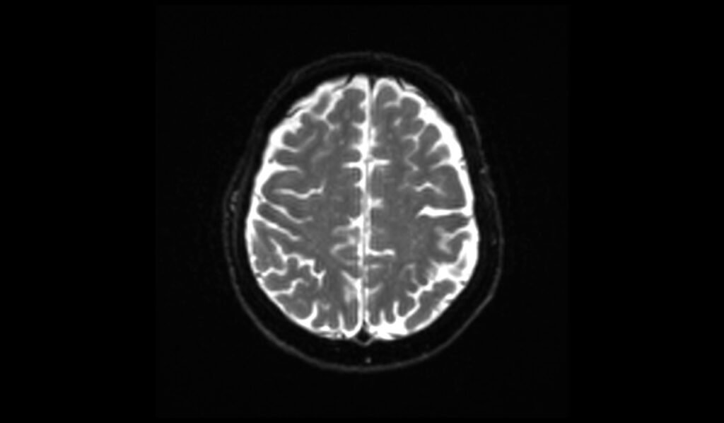 PLAN BRAIN IMAGE dwi - mrimaster