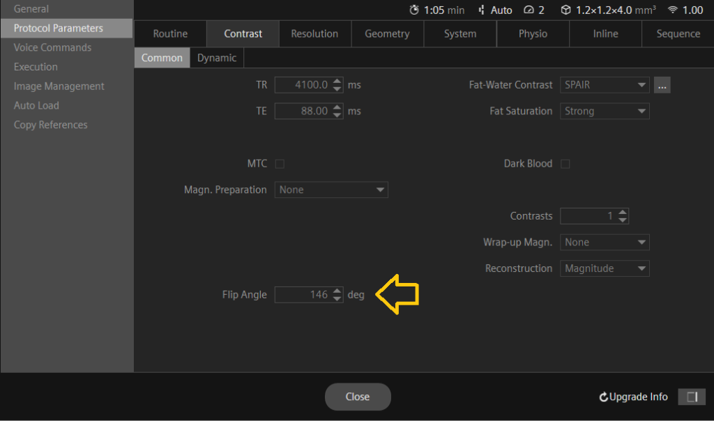 MRI Specific Absorption Rate(SAR) | how to calculate MRI SAR