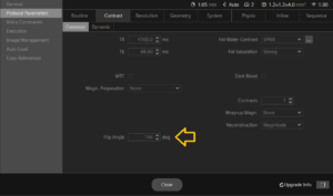 MRI Specific Absorption Rate(SAR) | how to calculate MRI SAR