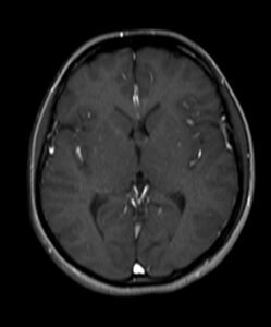 Brain MRI localiser images - mrimaster