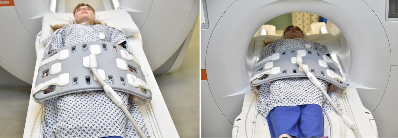 MRI female urethra planning | MRI urethra protocols and indications