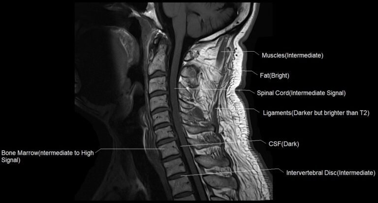 T1 vs T2 MRI | T1and T2 MRI image comparison