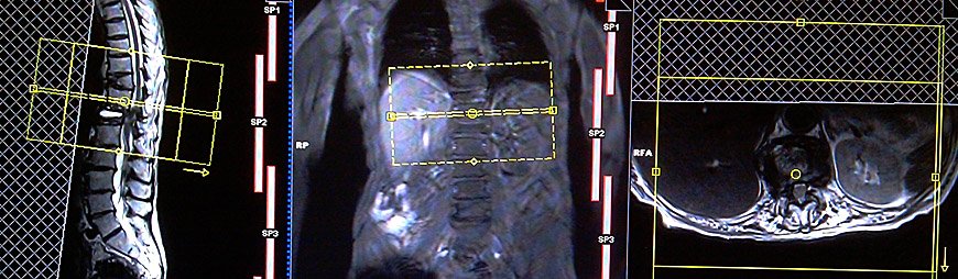lumbar spine MRI planning variations