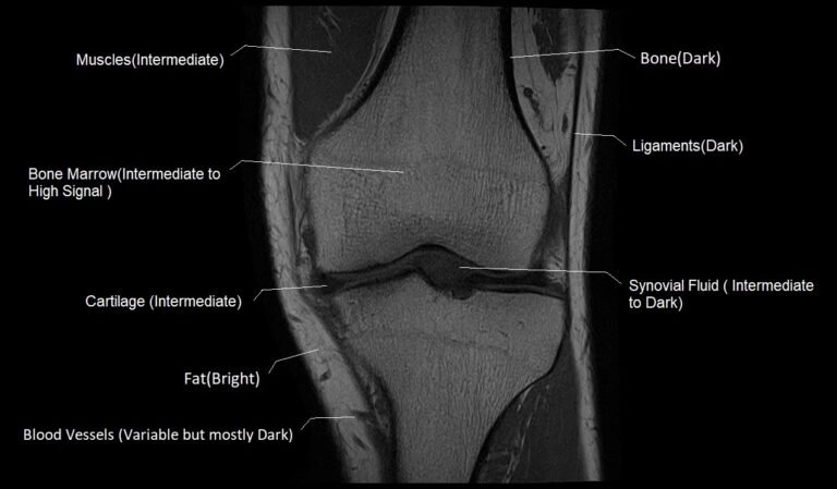 T1 vs T2 MRI | T1and T2 MRI image comparison
