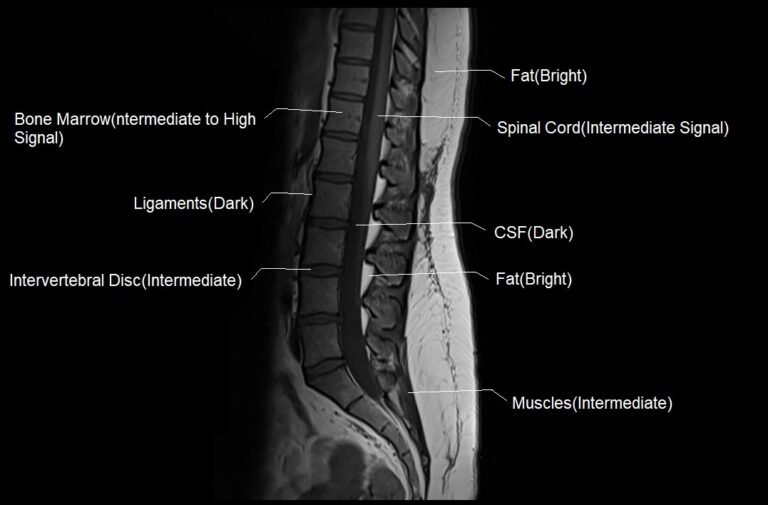 T1 vs T2 MRI | T1and T2 MRI image comparison