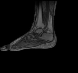 MRI localizer (scout or survey scan) | T1,T2 and 3D localizers