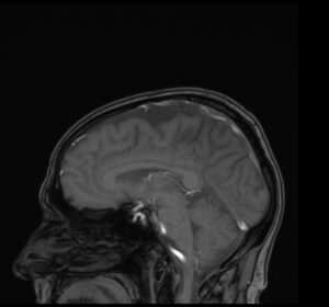 MRI localizer (scout or survey scan) | T1,T2 and 3D localizers