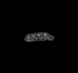 MRI localizer (scout or survey scan) | T1,T2 and 3D localizers
