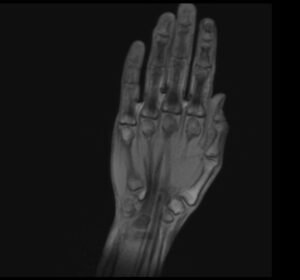 MRI localizer (scout or survey scan) | T1,T2 and 3D localizers