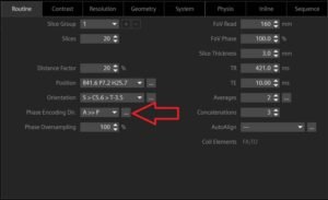 Phase encoding in MRI | MRI Phase encoding direction