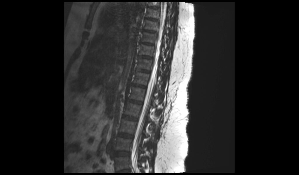 CISS MRI sequence | FIESTA-C MRI | phase balanced sarge | PBSG physics ...