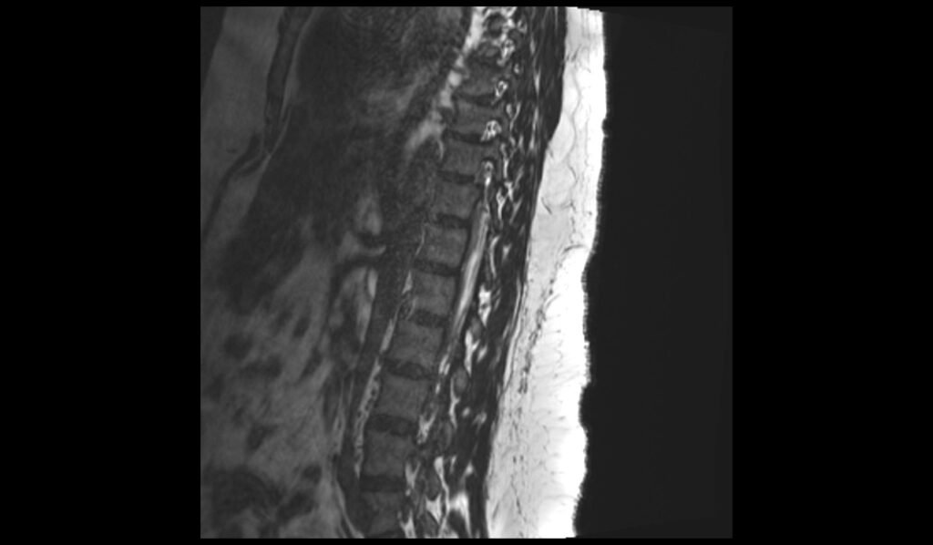CISS MRI sequence | FIESTA-C MRI | phase balanced sarge | PBSG physics ...