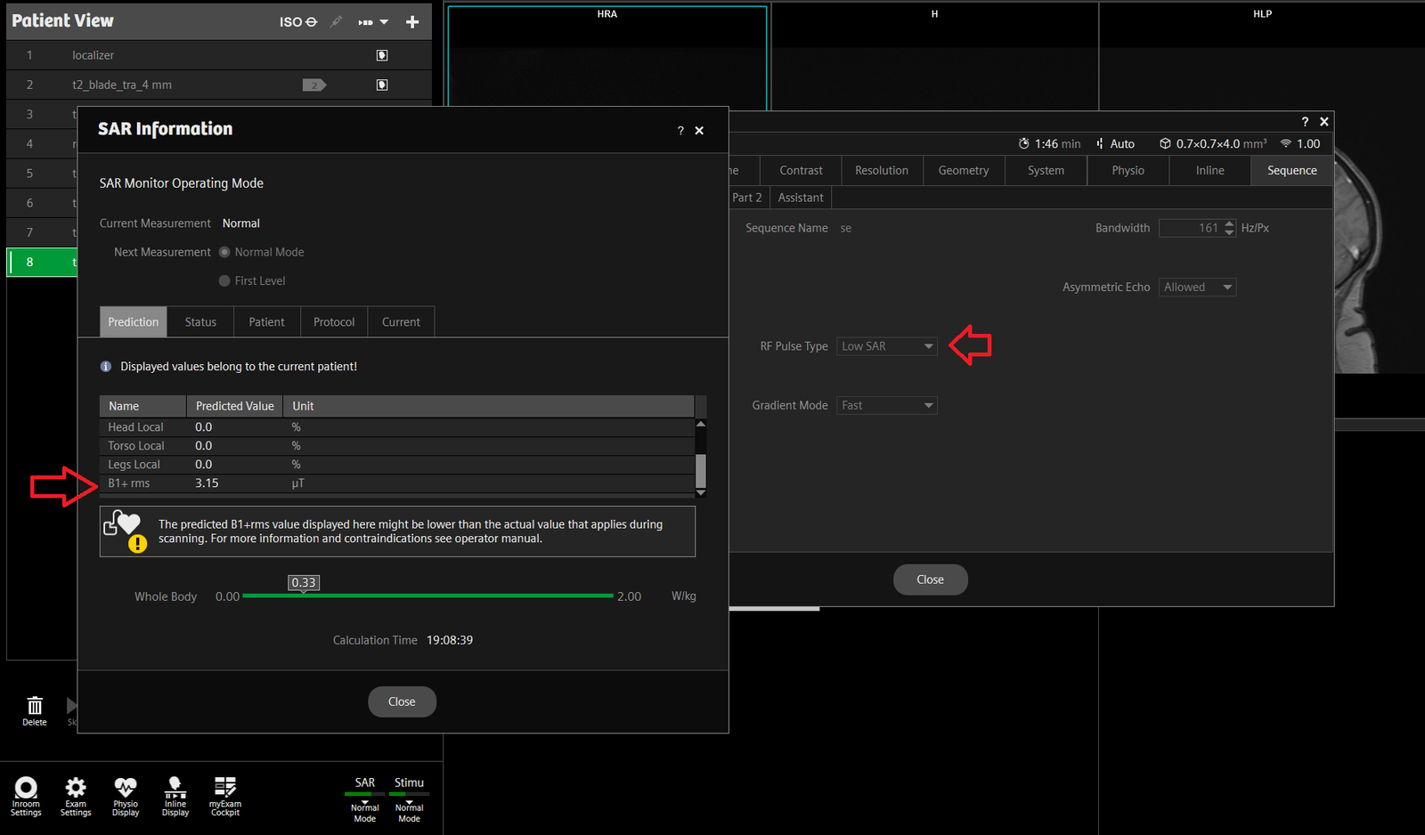 5 gauss line in MRI | Locating the Gauss Line