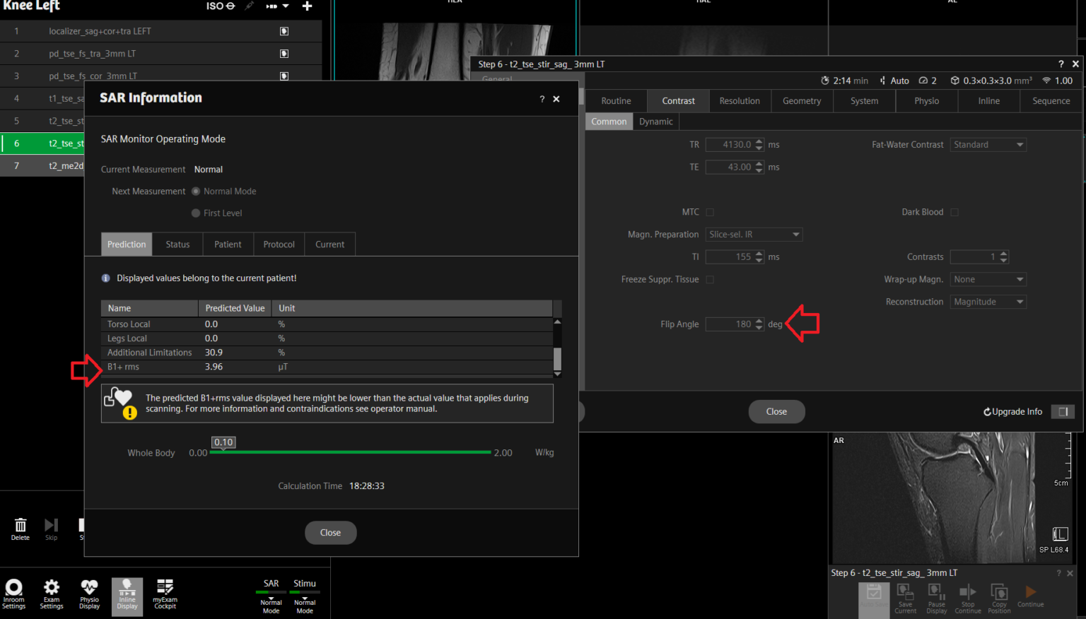 5 gauss line in MRI | Locating the Gauss Line