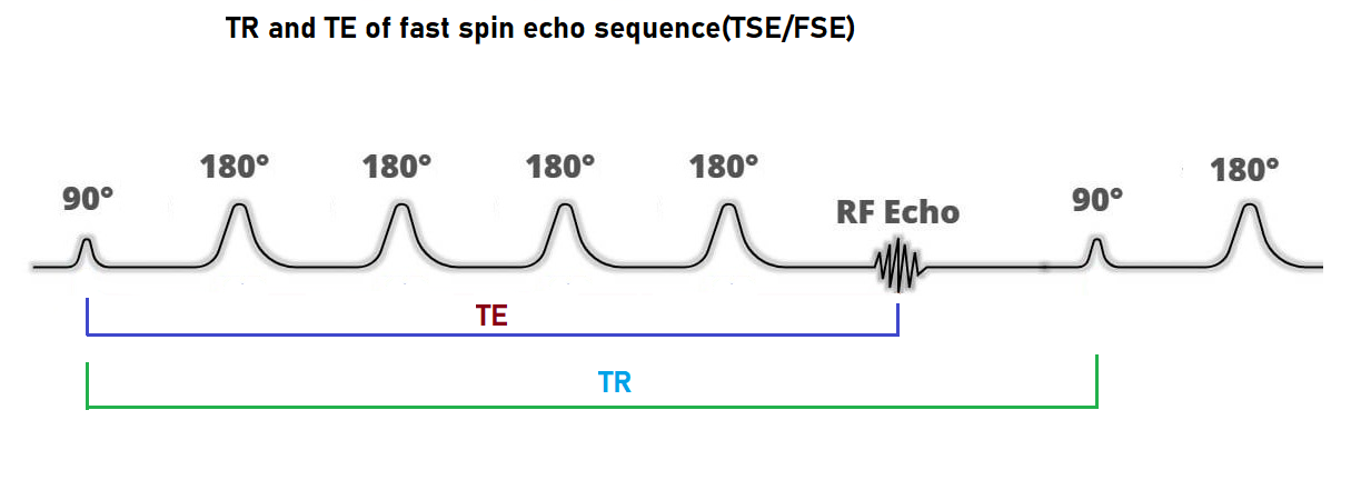 TR and TE in MRI | TR (repetition time),TE (echo time) and image contrast