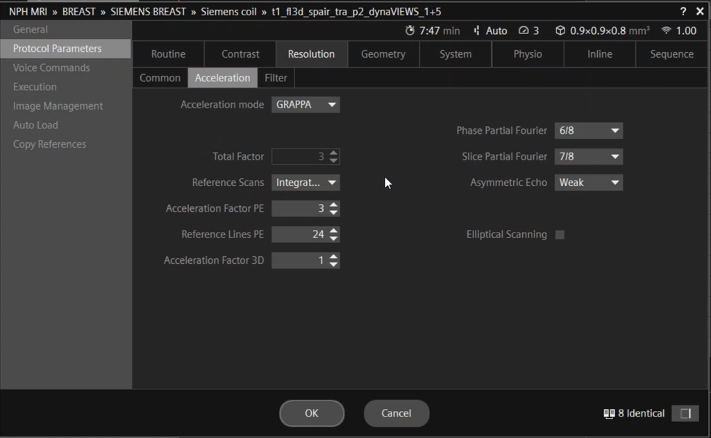 Temporal Resolution in MRI | How to Calculate Temporal Resolution