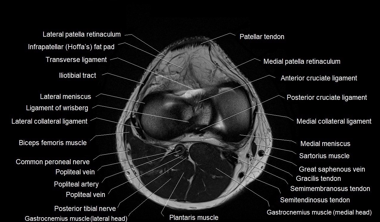 Knee Muscle Anatomy Mri Atlas Of Knee Mri Anatomy Wradiology