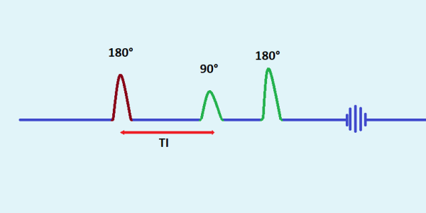 TI MRI | Inversion time for FLAIR,STIR and PSIR
