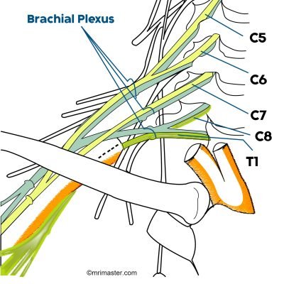 Brachial Plexus Nerves